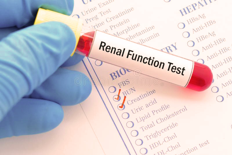 Pemeriksaan Fungsi Ginjal | OTC Digest